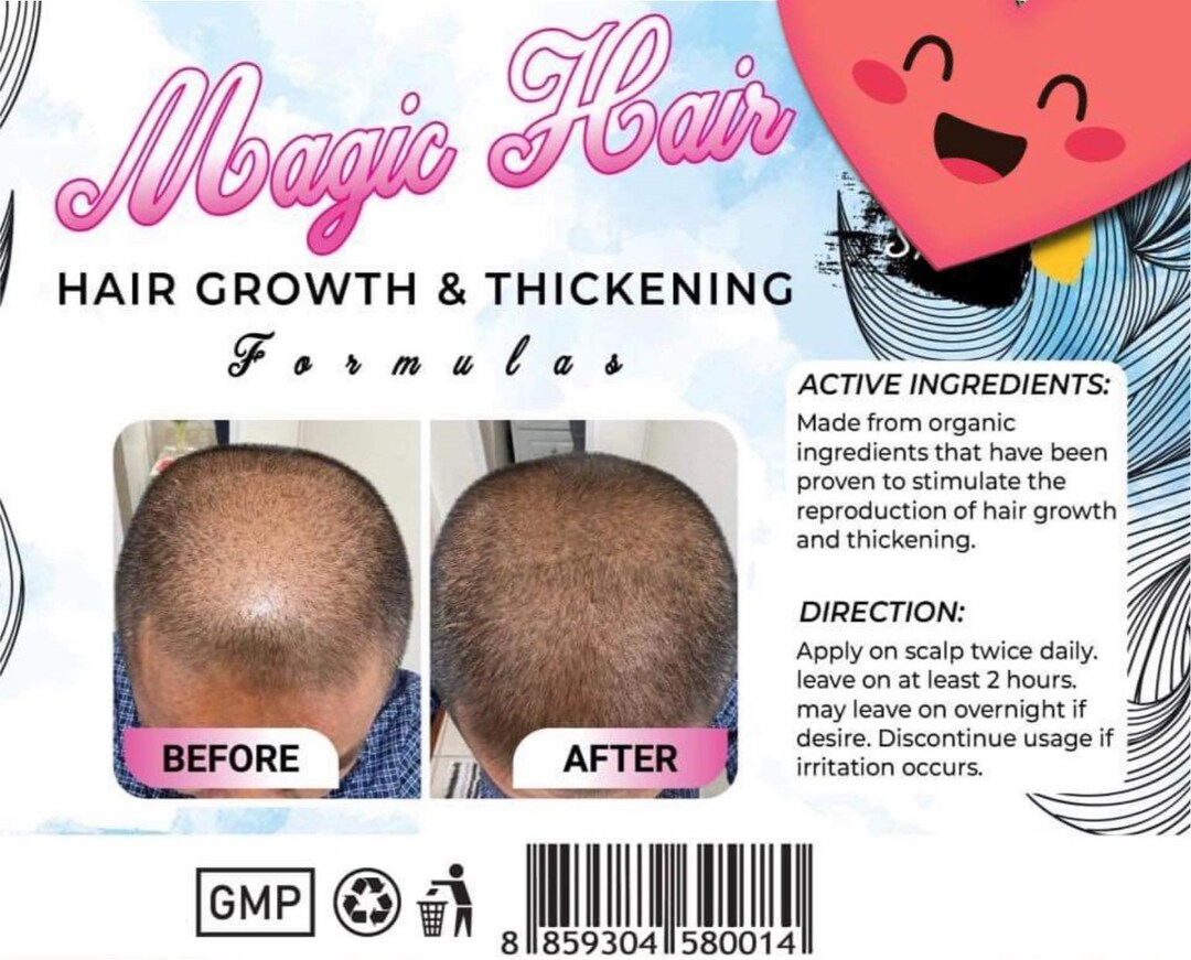 Magic Hair Regrow and Thickening Formula - Etsy