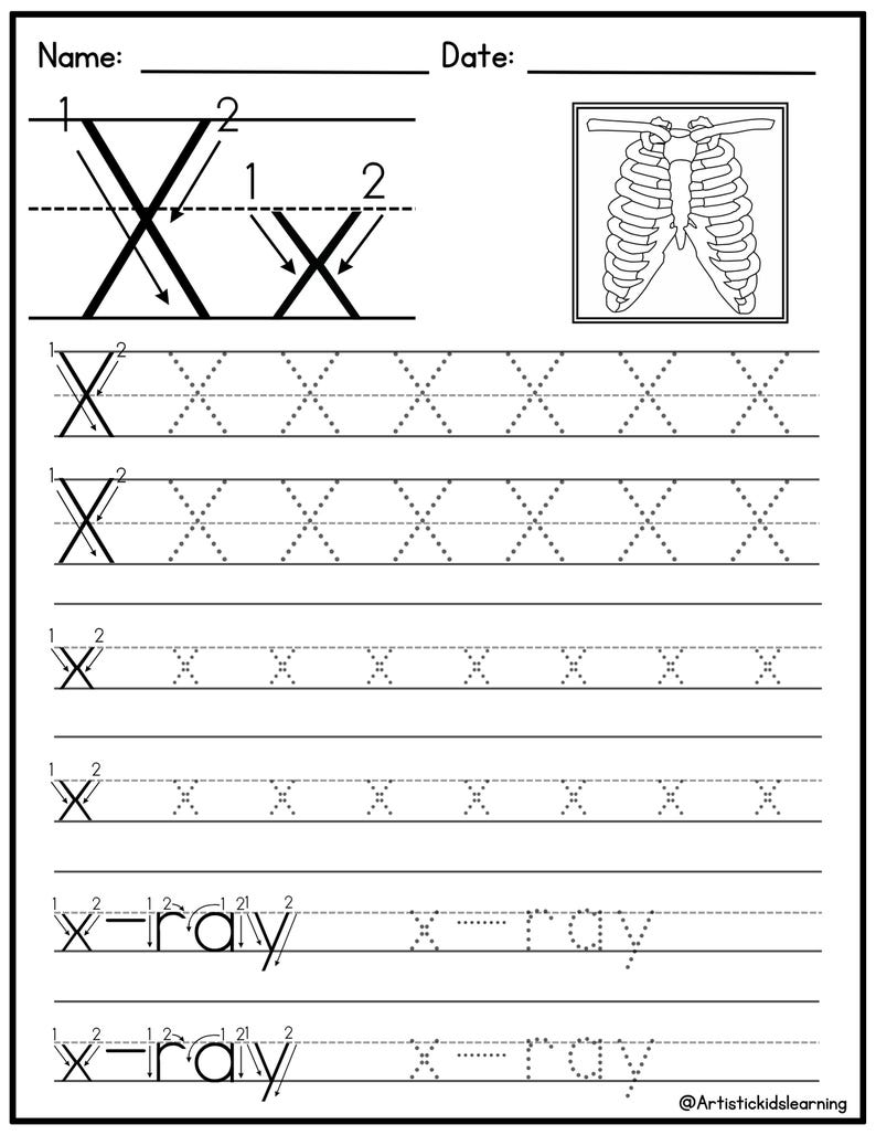 52 Alphabet Tracing Worksheets | Uppercase & Lowercase Letters A–Z | 52 ...