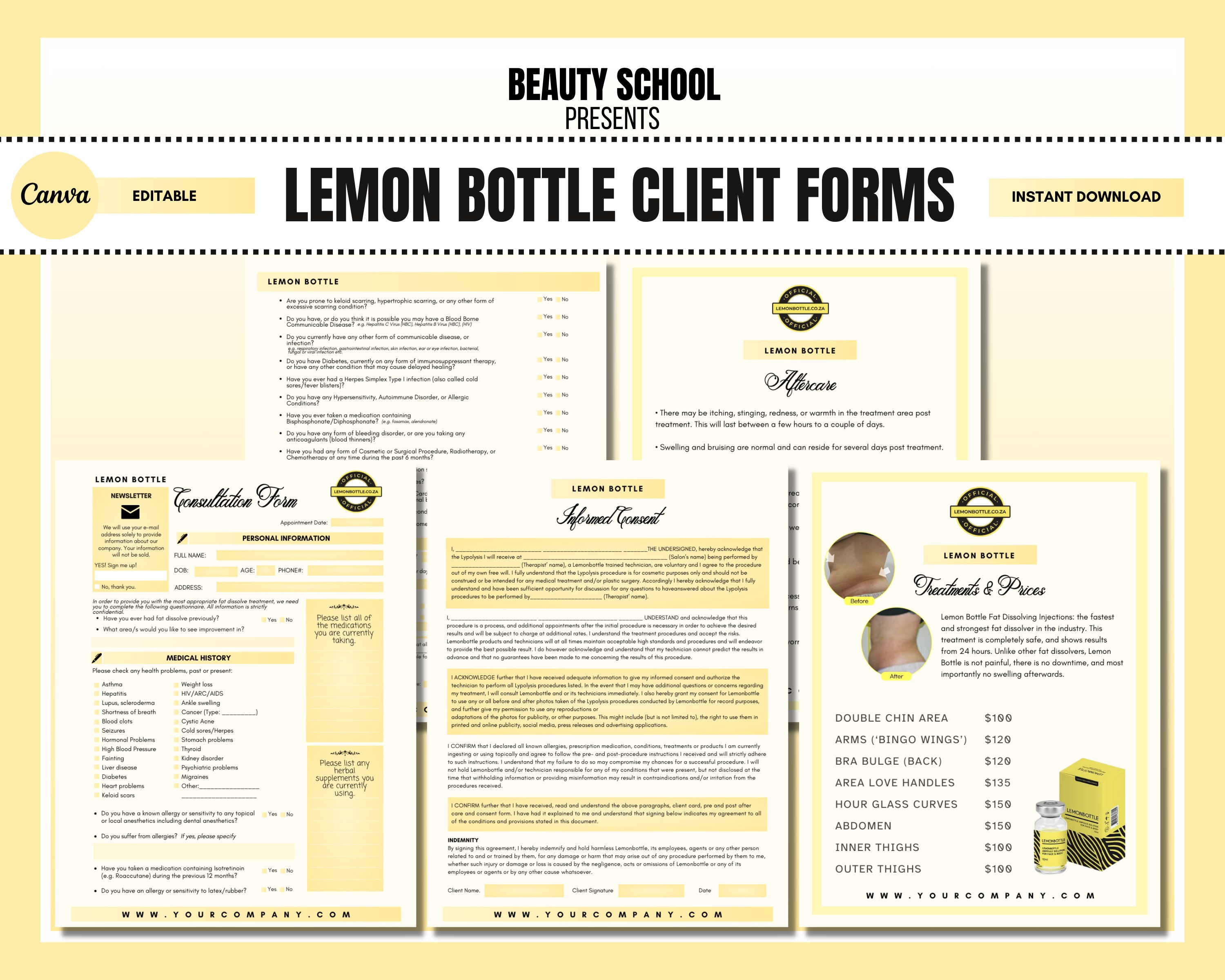 Lemon Bottle Consent Forms, Lemon Bottle Treatment Forms, Lemon Bottle ...