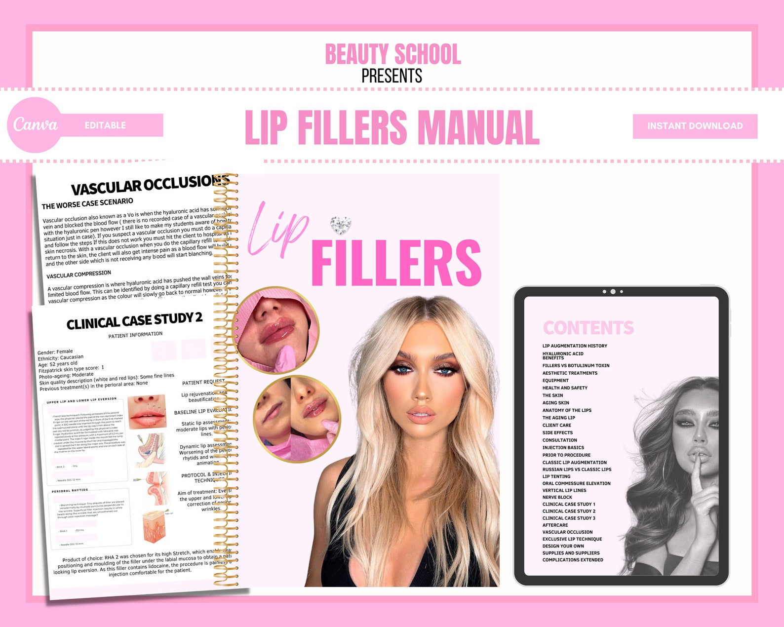Lip Fillers Manual, Lip Injections Training Manual, Lip Augmentation, Training Course ...