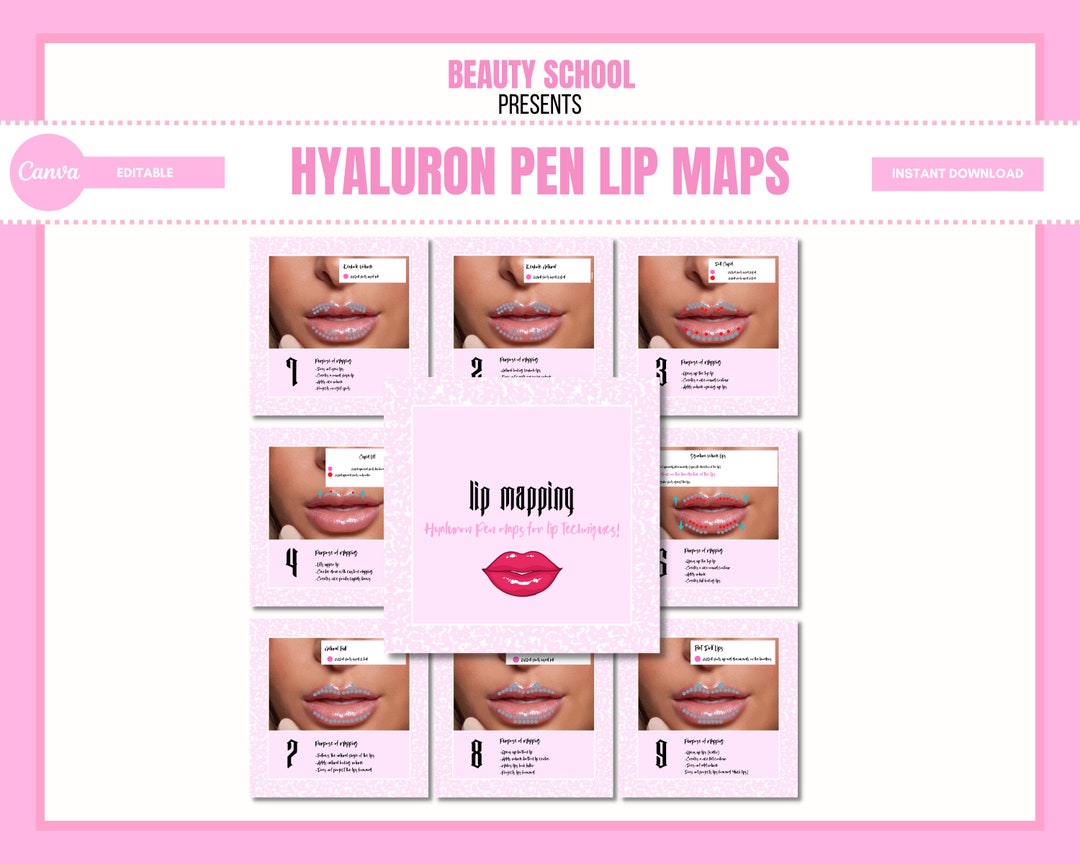 Hyaluron Pen Lip Maps, Lip Mapping Guides, Techniques, Russian Lips ...