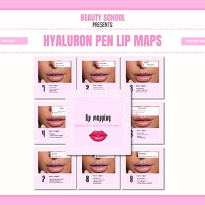 Hyaluron Pen Lip Maps, Lip Mapping Guides, Techniques, Russian Lips ...