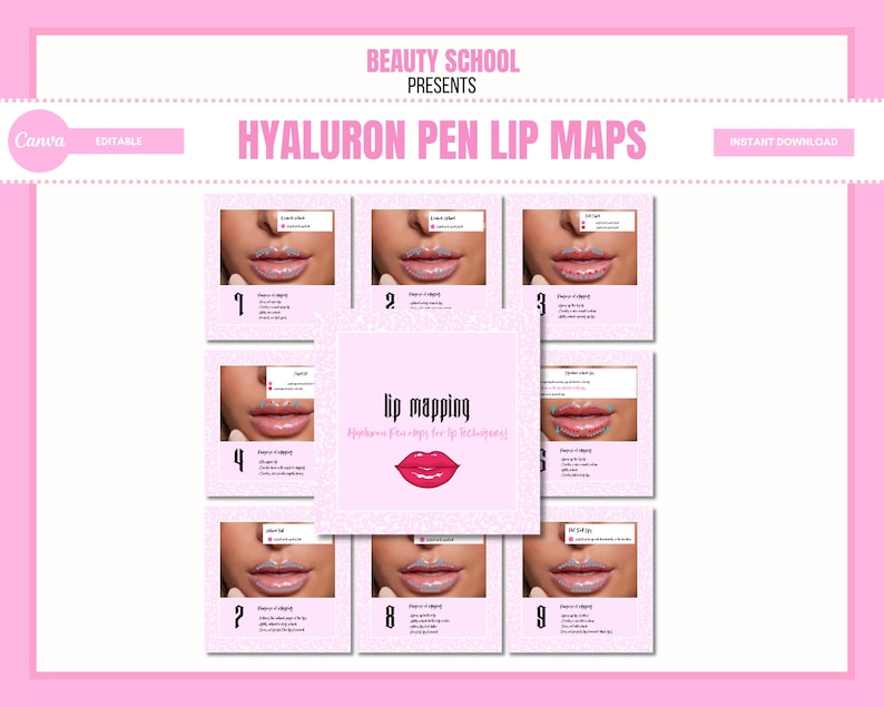 Hyaluron Pen Lip Maps, Lip Mapping Guides, Techniques, Russian Lips ...