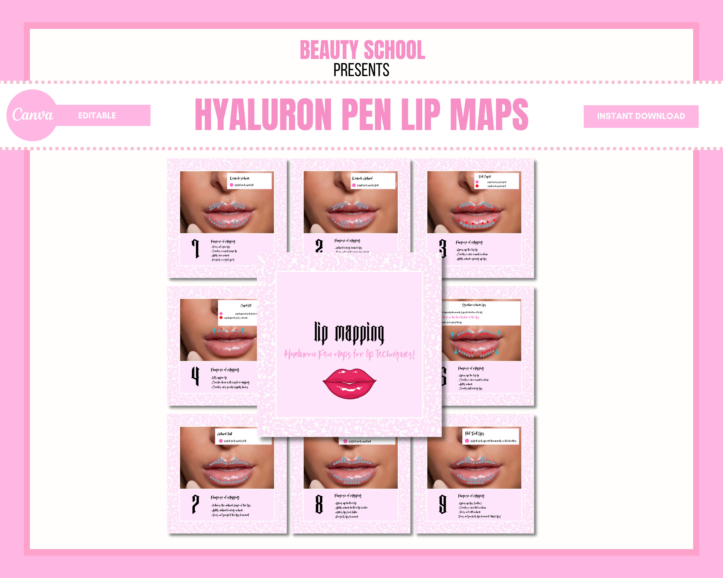 Hyaluron Pen Lip Maps, Lip Mapping Guides, Techniques, Russian Lips ...