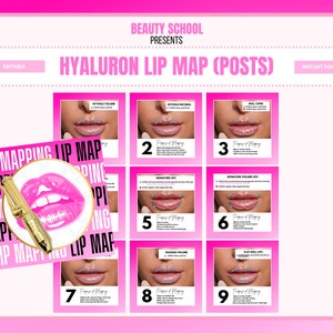 Hyaluron Pen Flyer Lip Maps, Lip Mapping Guides, Techniques, Russian ...