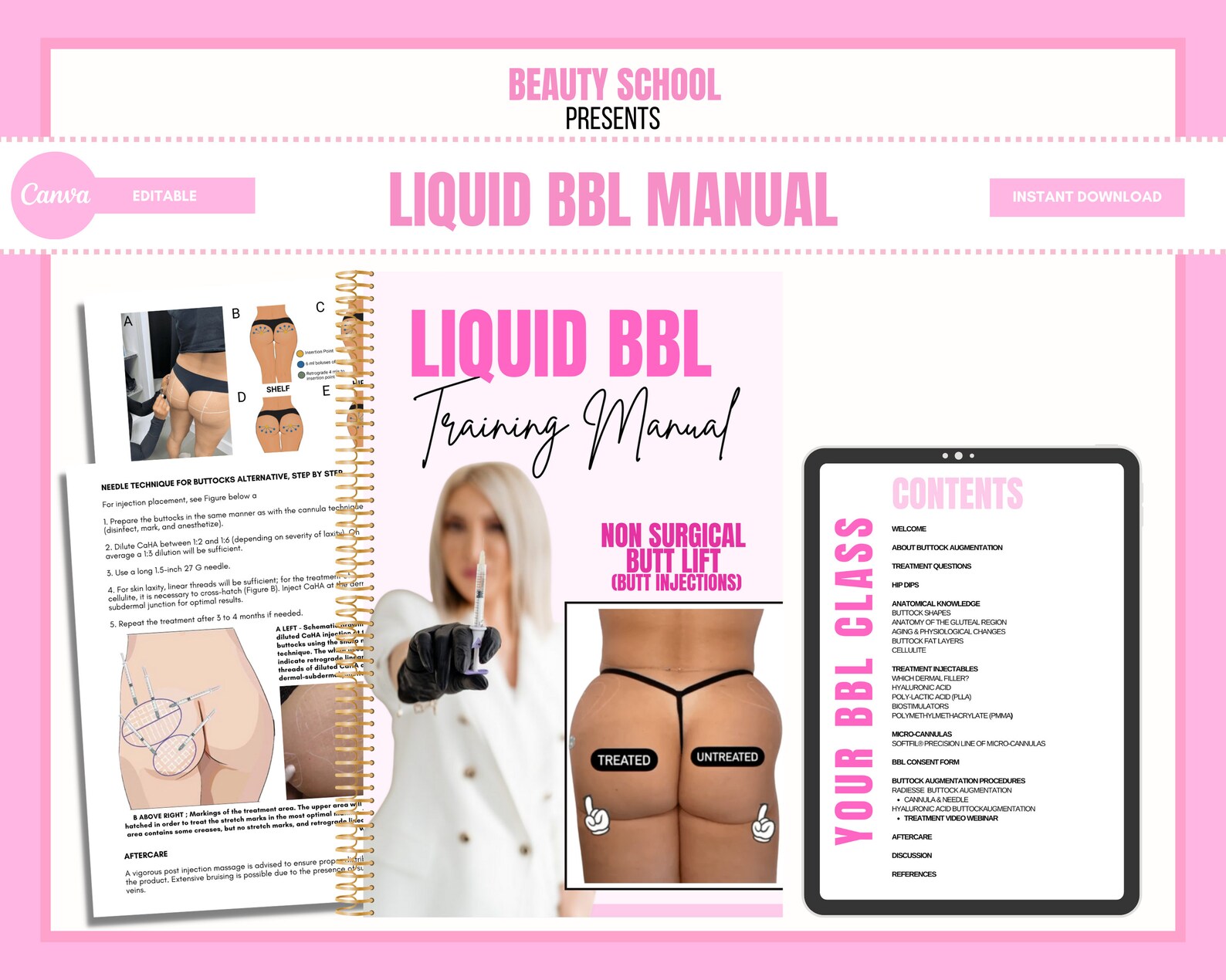 Buttock Augmentation Digital Editable Training Manual Guide, Training Resource, Buttock Filler ...