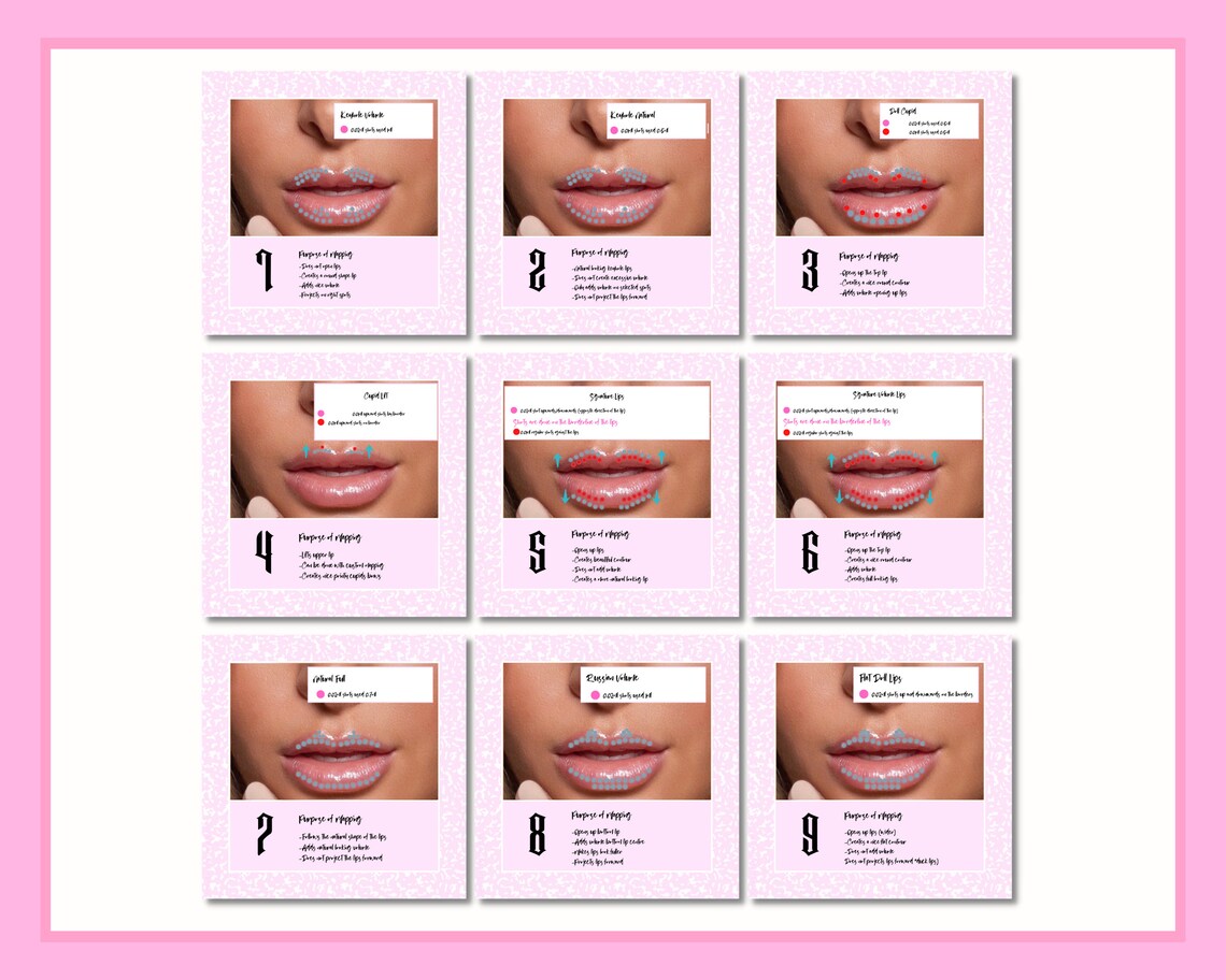 Hyaluron Pen Lip Maps, Lip Mapping Guides, Techniques, Russian Lips ...