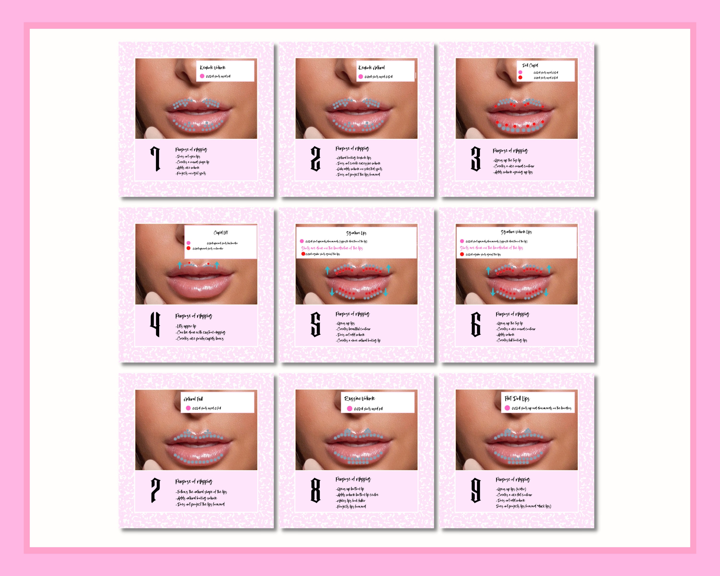 Hyaluron Pen Lip Maps, Lip Mapping Guides, Techniques, Russian Lips ...