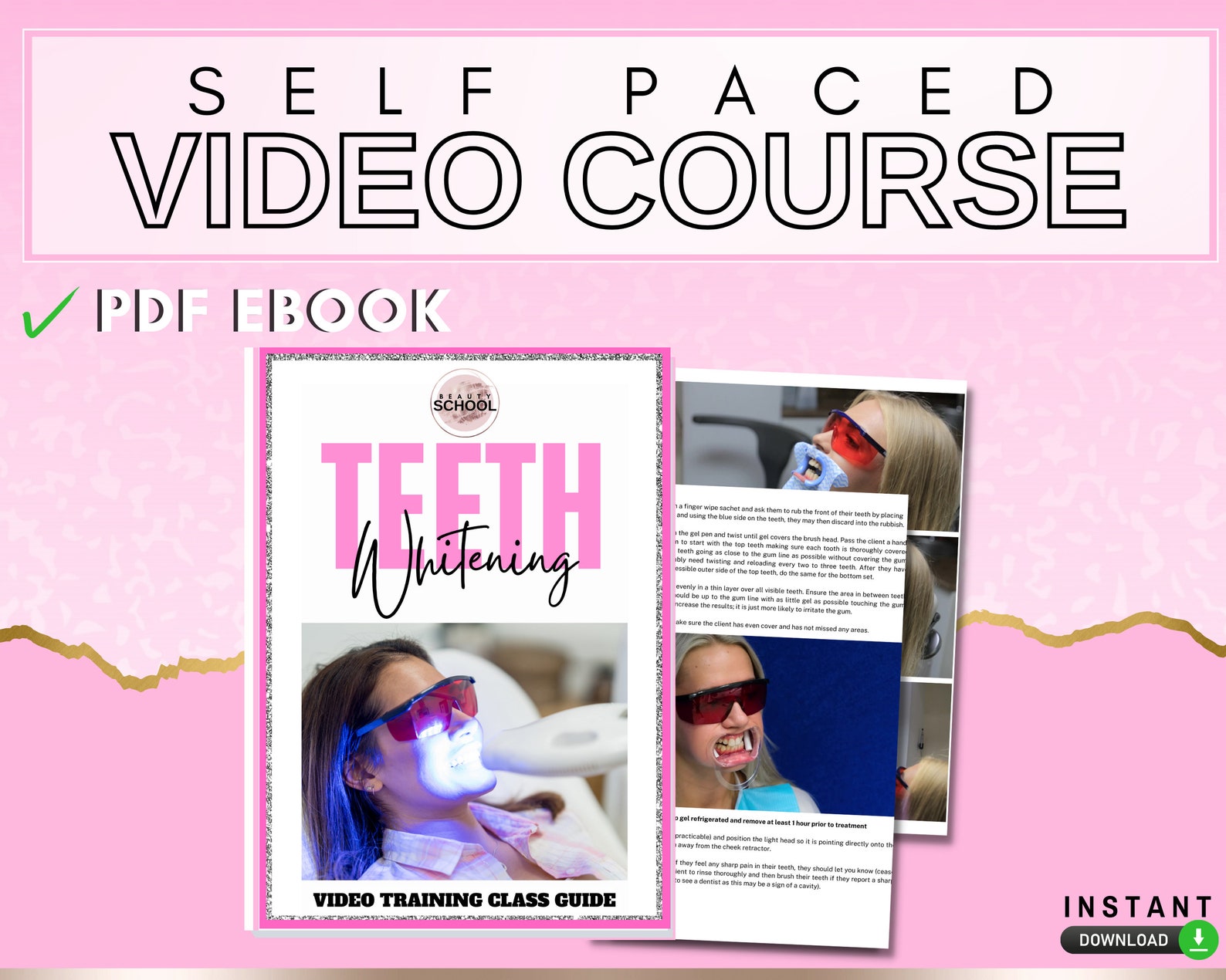 Teeth Whitening, Teeth Whitening Online Course, Teeth Whitening ...