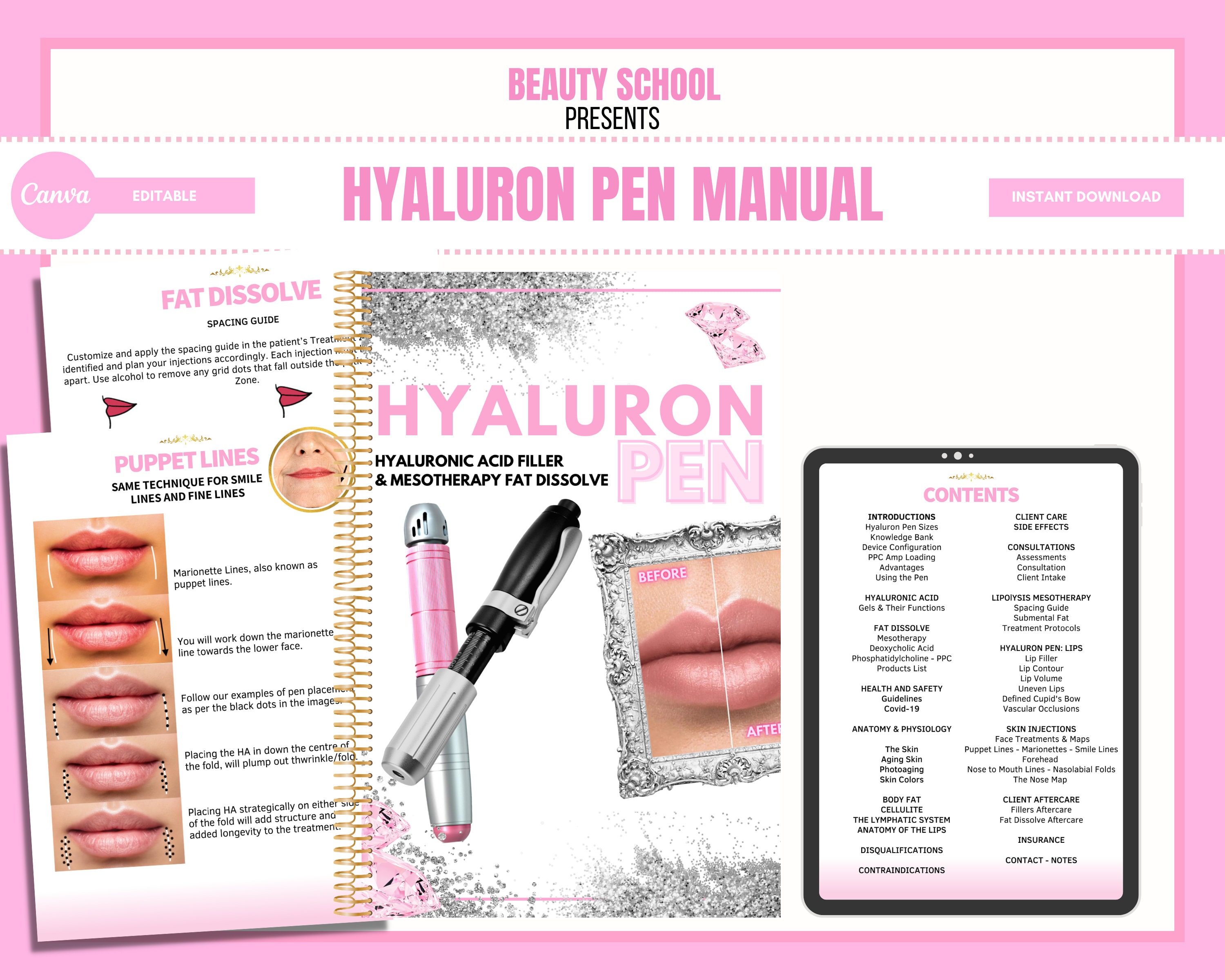 Hyaluron Pen Training Manual, Lip Mapping, Certificates, Diploma, Fat ...
