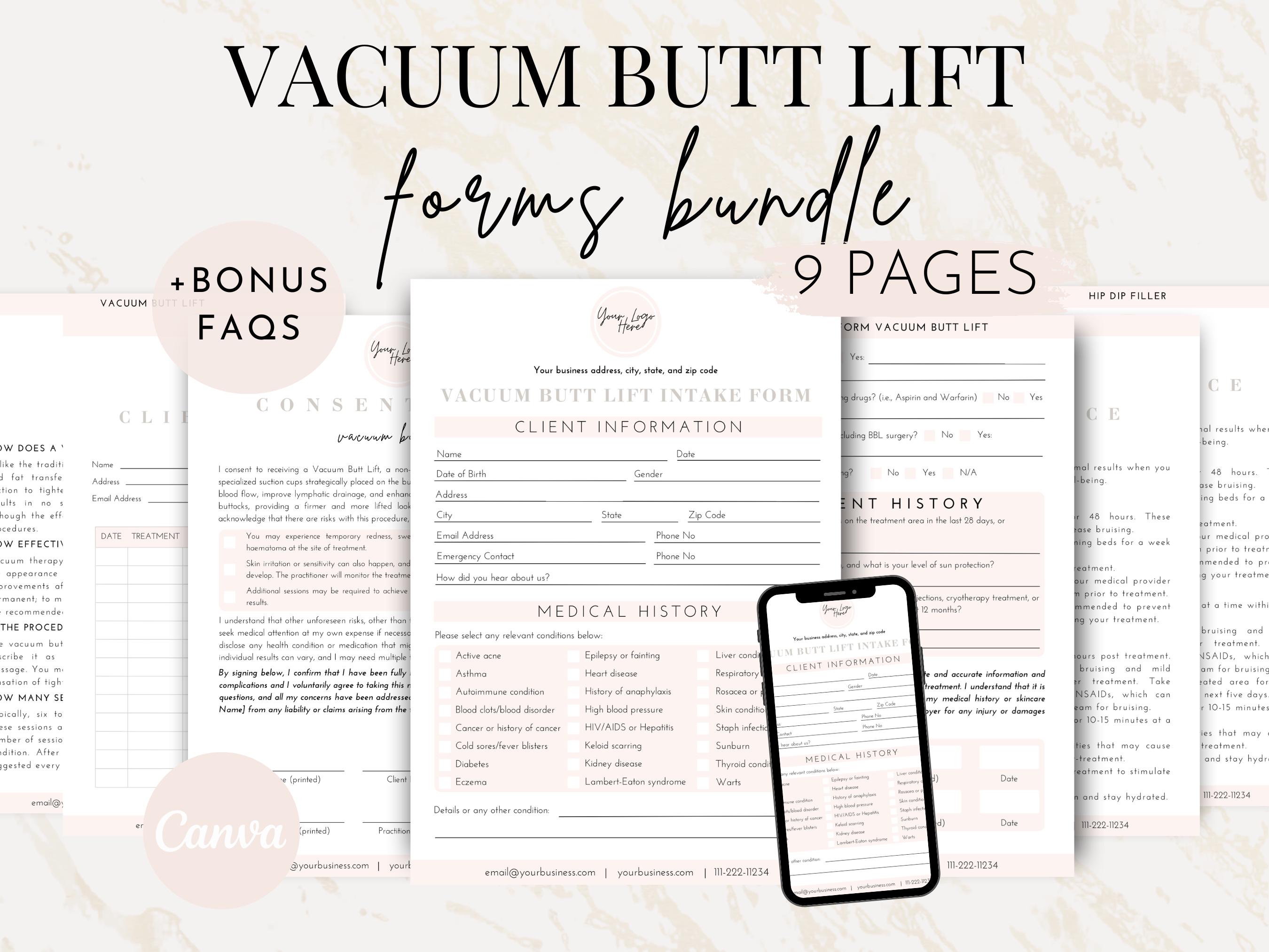Editable Vacuum Butt Lift Therapy Consent Forms, Printable Vacuum ...