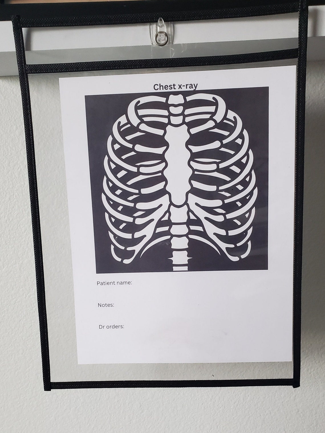 Printable X-ray for Kids / Pretend Doctor Printables / Play at Home ...