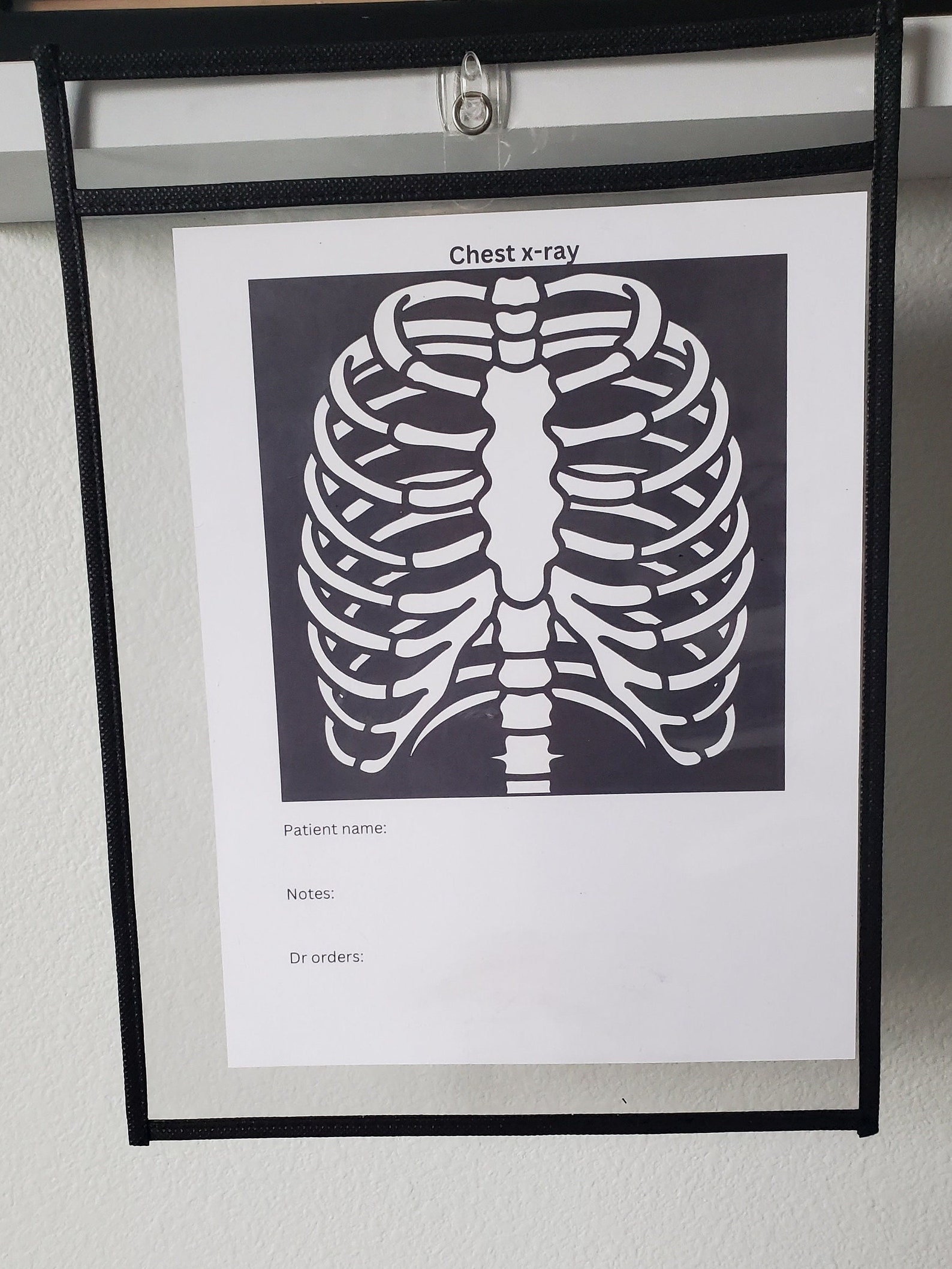 Printable X-ray for Kids / Pretend Doctor Printables / Play at Home ...