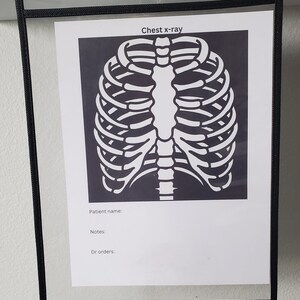 Printable X-ray for Kids / Pretend Doctor Printables / Play at Home ...