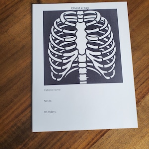 Printable X-ray for Kids / Pretend Doctor Printables / Play at Home ...