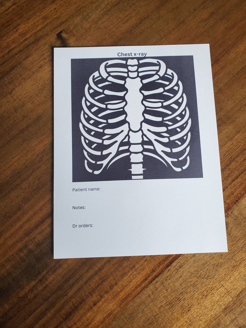 Printable X-ray for Kids / Pretend Doctor Printables / Play at Home ...