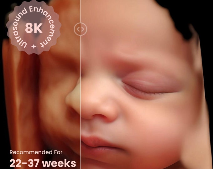 8K Enhanced Ultrasound: From Bumps to Realistic Faces Precision 3D/4D/5D/HD Imaging Perfect Baby ...