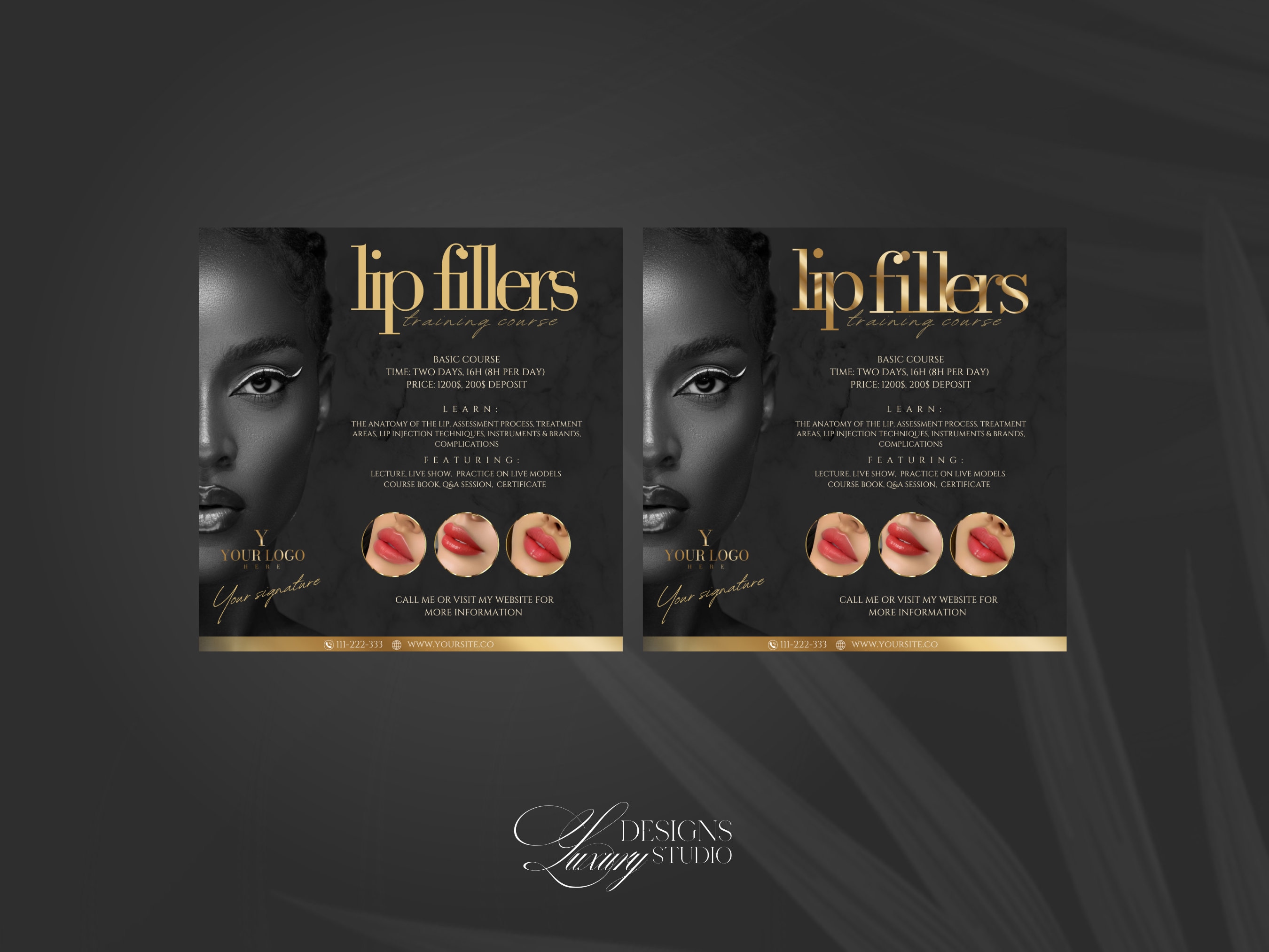 Lip Filler Masterclass Flyer: Elegant Gold & Black Canva Template - Etsy
