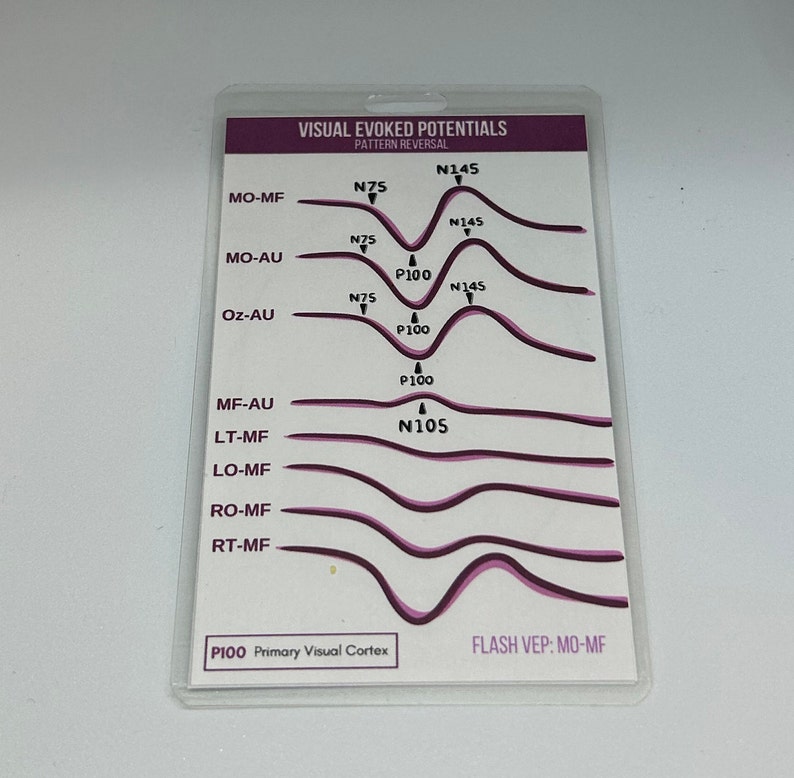 Evoked Potentials Badge Reference Cards - Etsy