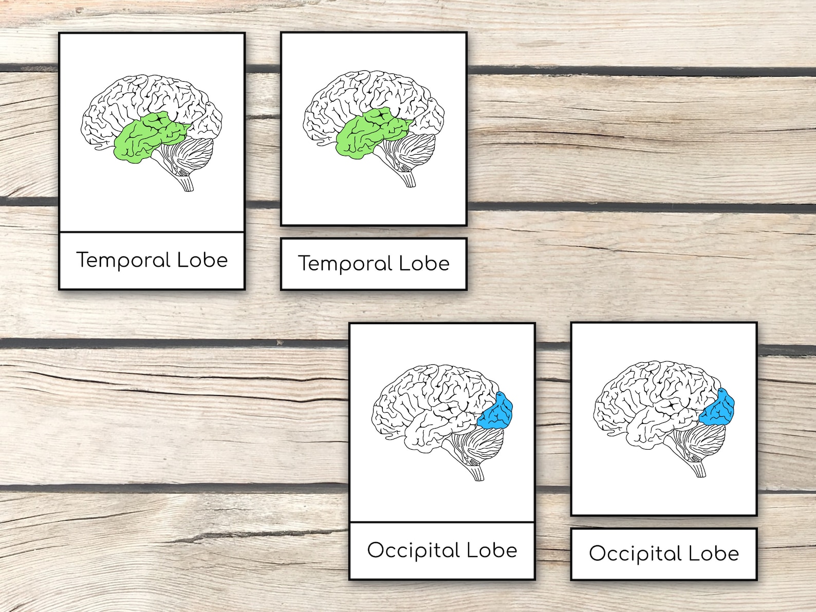 Brain Anatomy Montessori Cards, Brain Anatomy Cards, 3-part Cards ...