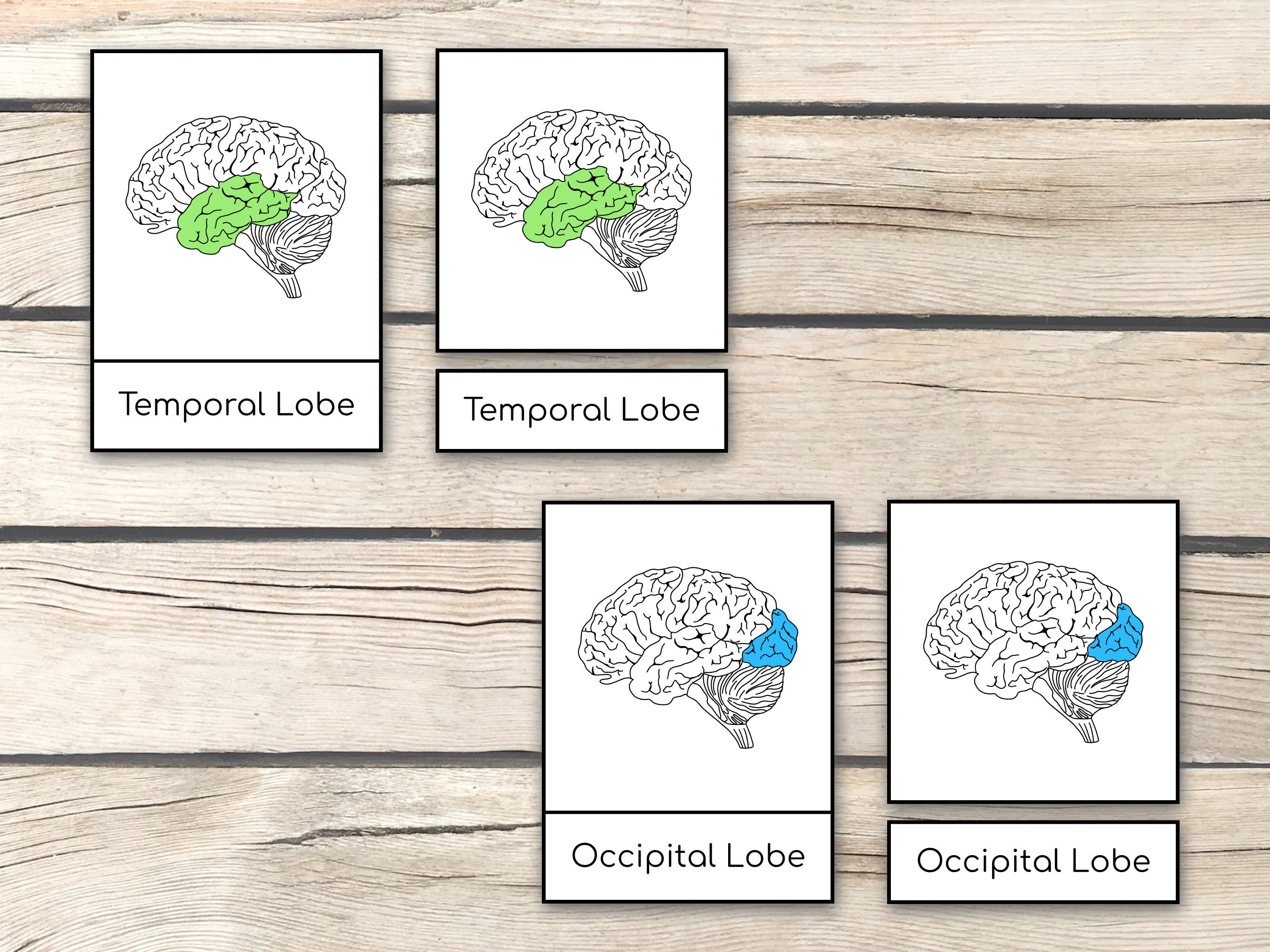 Brain Anatomy Montessori Cards, Brain Anatomy Cards, 3-part Cards ...