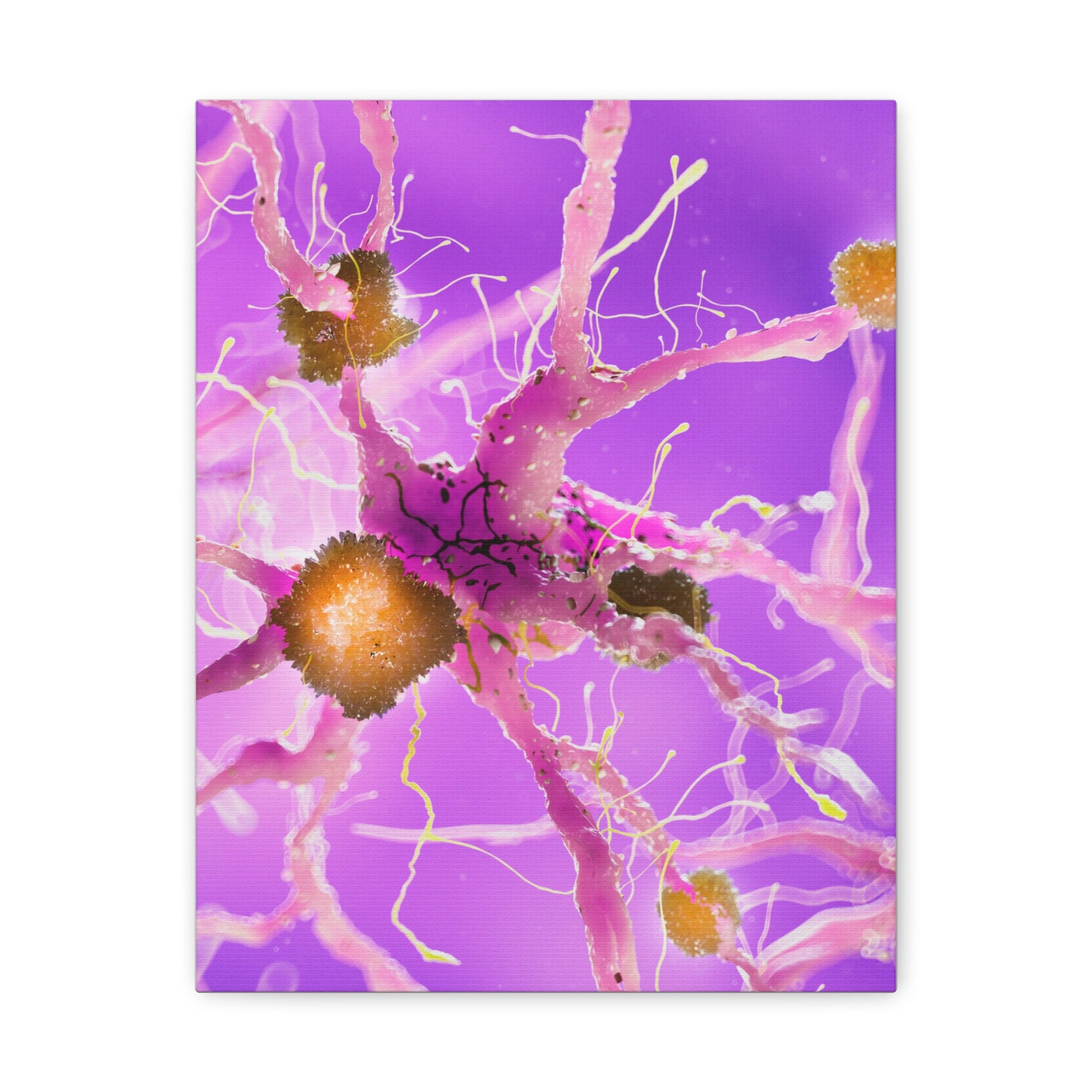 Nerve Cells With Amyloid Plaques Illustration Canvas Gallery Wraps - Etsy