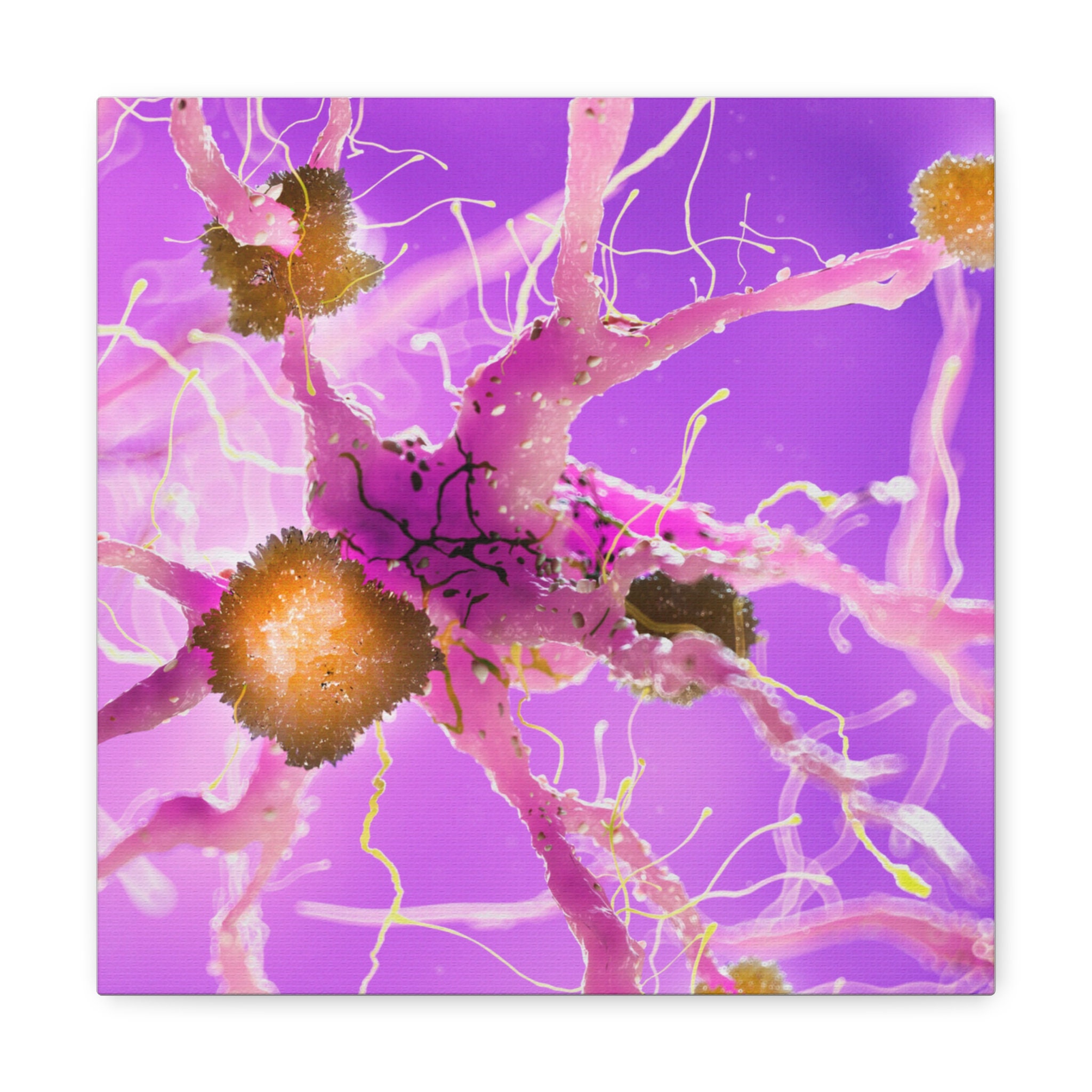 Nerve Cells With Amyloid Plaques Illustration Canvas Gallery Wraps - Etsy