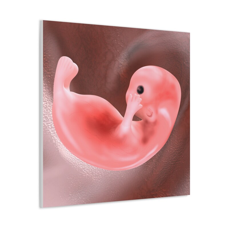 Human Embryo Illustration Human Anatomy Canvas Gallery Wraps - Etsy