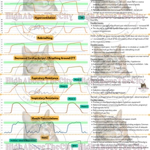 Printable Veterinary ETCO2 Capnography Guide - Etsy