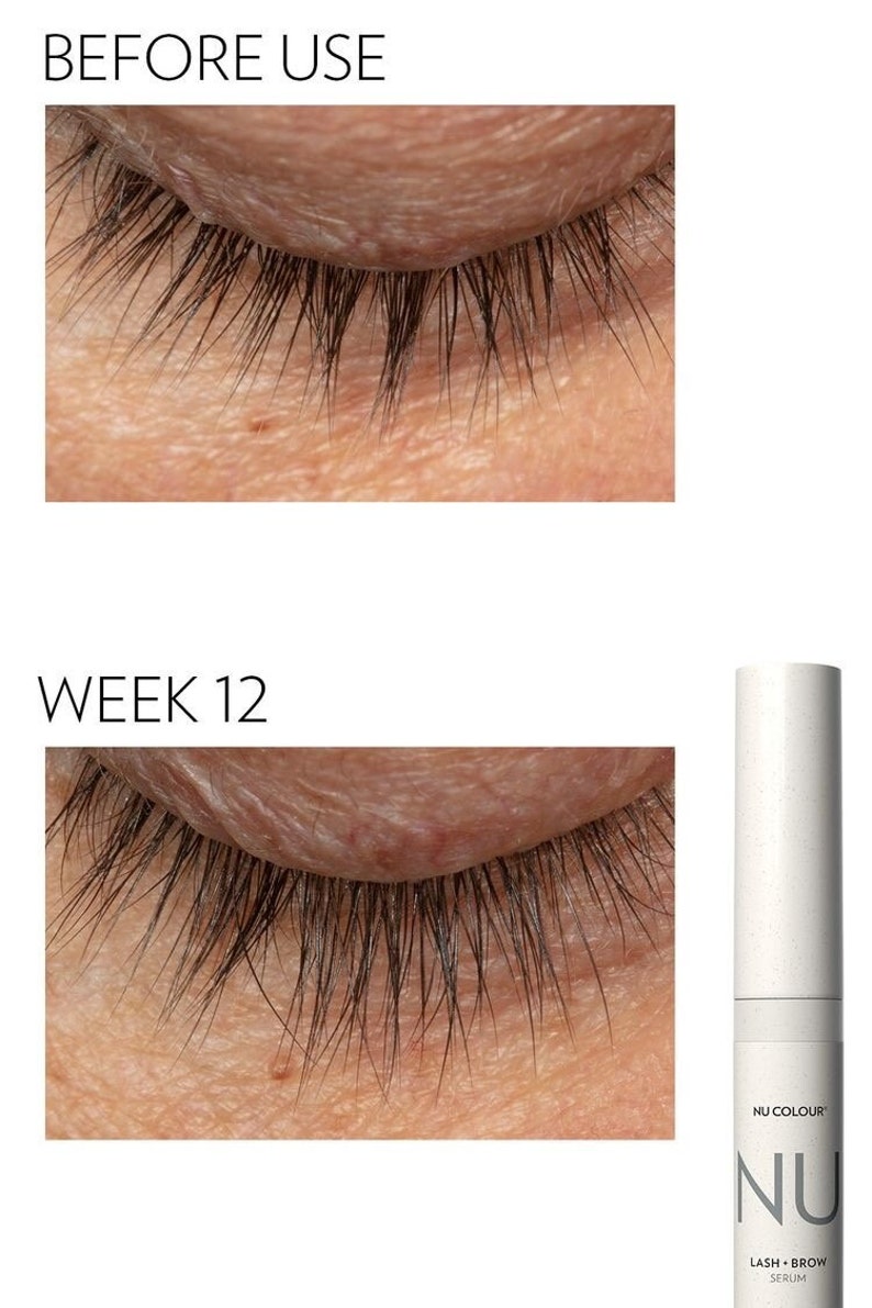 Lash & Brow Serum, Longer Lashes, Fuller Lashes, Transform Lashes and ...