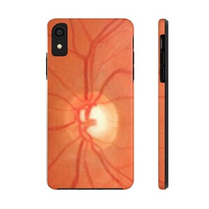 Optometry Phone Case Optometrist iPhone Case Ophthalmologist Retina ...