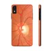 Optometry Phone Case Optometrist iPhone Case Ophthalmologist Retina ...
