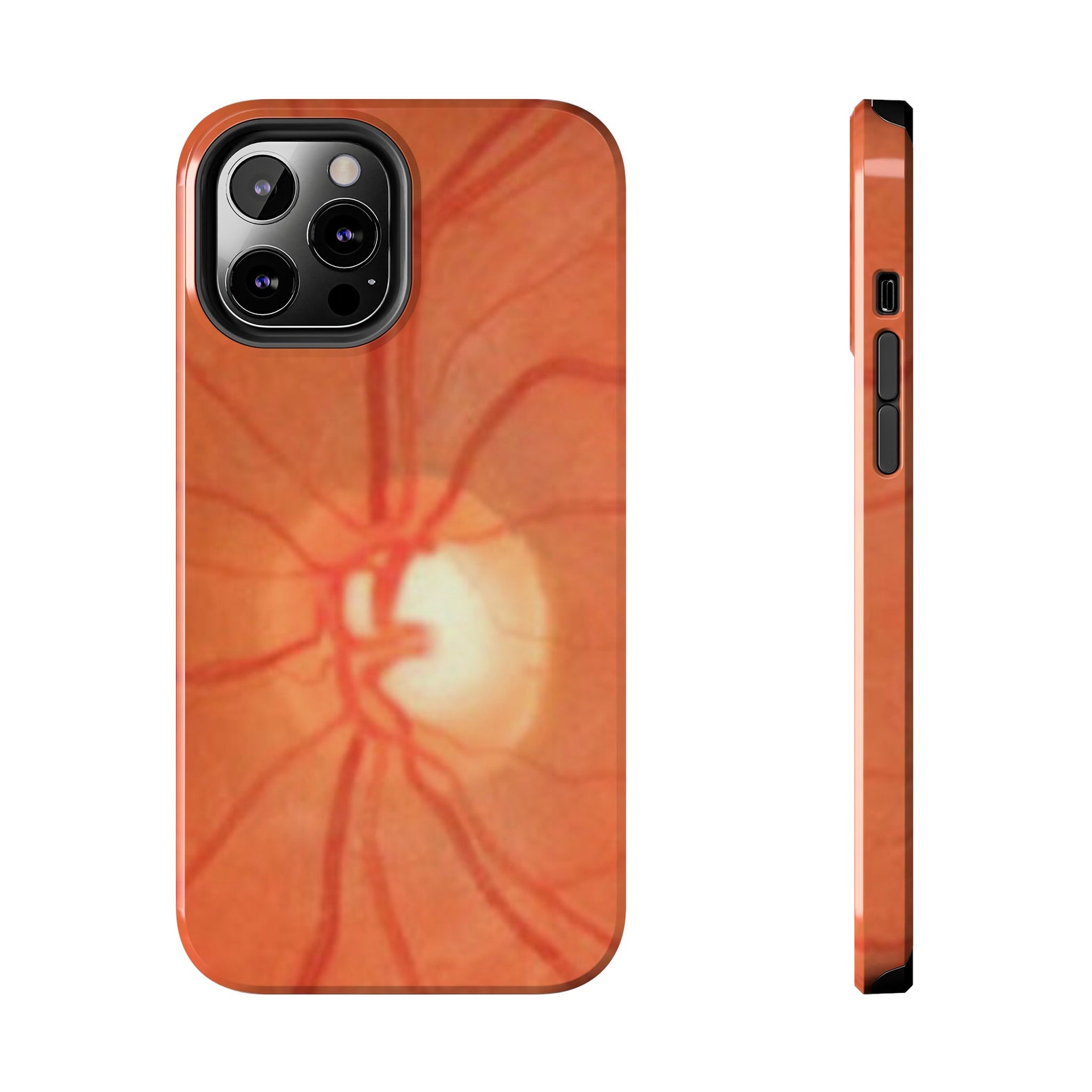 Optometry Phone Case Optometrist iPhone Case Ophthalmologist Retina ...