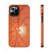 Optometry Phone Case Optometrist iPhone Case Ophthalmologist Retina ...