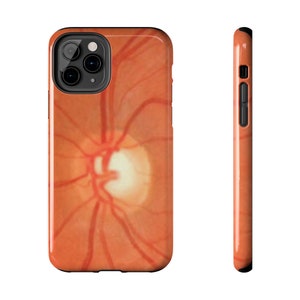 Optometry Phone Case Optometrist iPhone Case Ophthalmologist Retina ...
