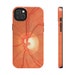 Optometry Phone Case Optometrist iPhone Case Ophthalmologist Retina ...