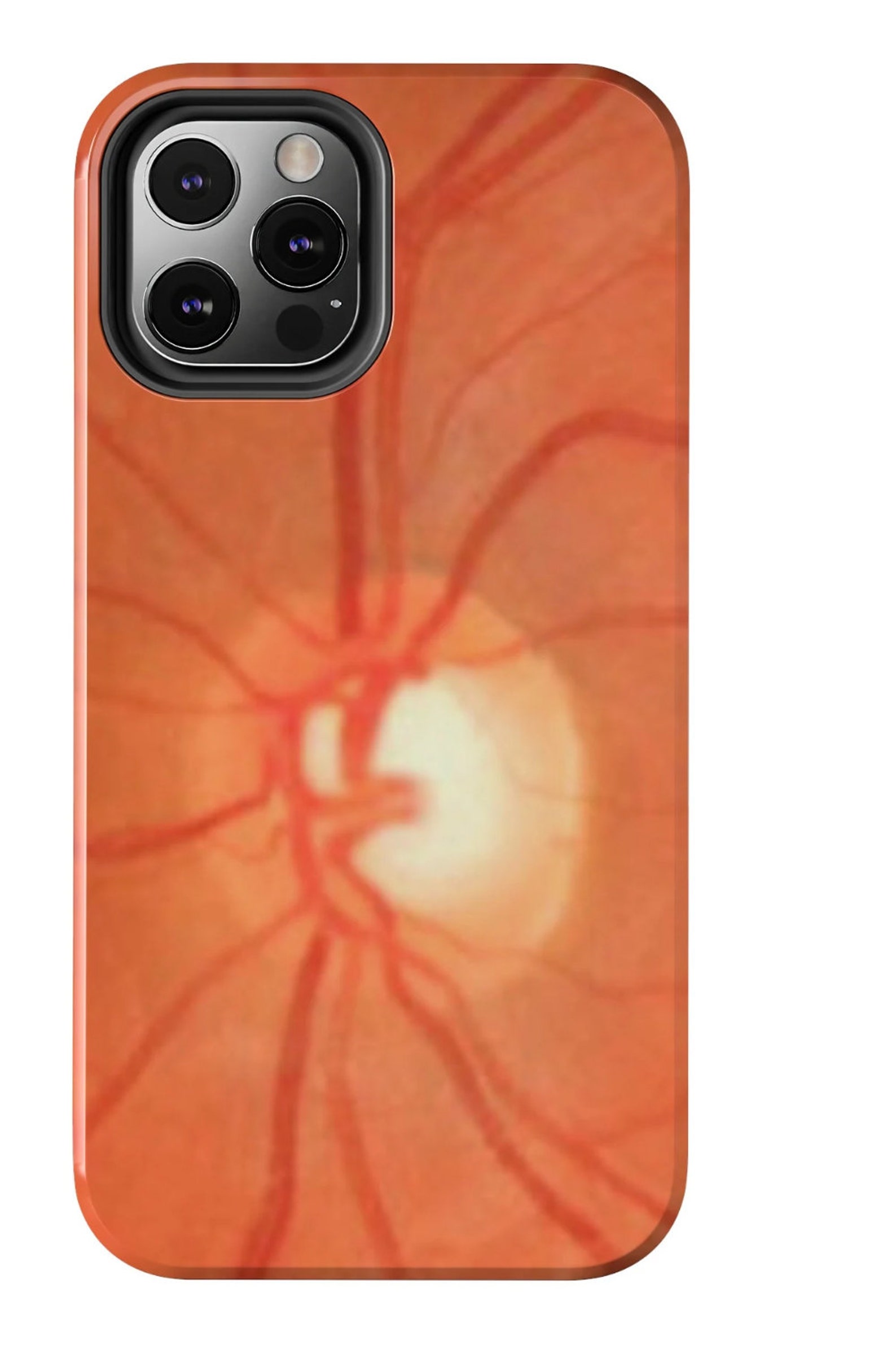 Optometry Phone Case Optometrist iPhone Case Ophthalmologist Retina ...