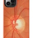Optometry Phone Case Optometrist iPhone Case Ophthalmologist Retina ...