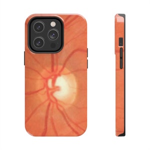 Optometry Phone Case Optometrist iPhone Case Ophthalmologist Retina ...
