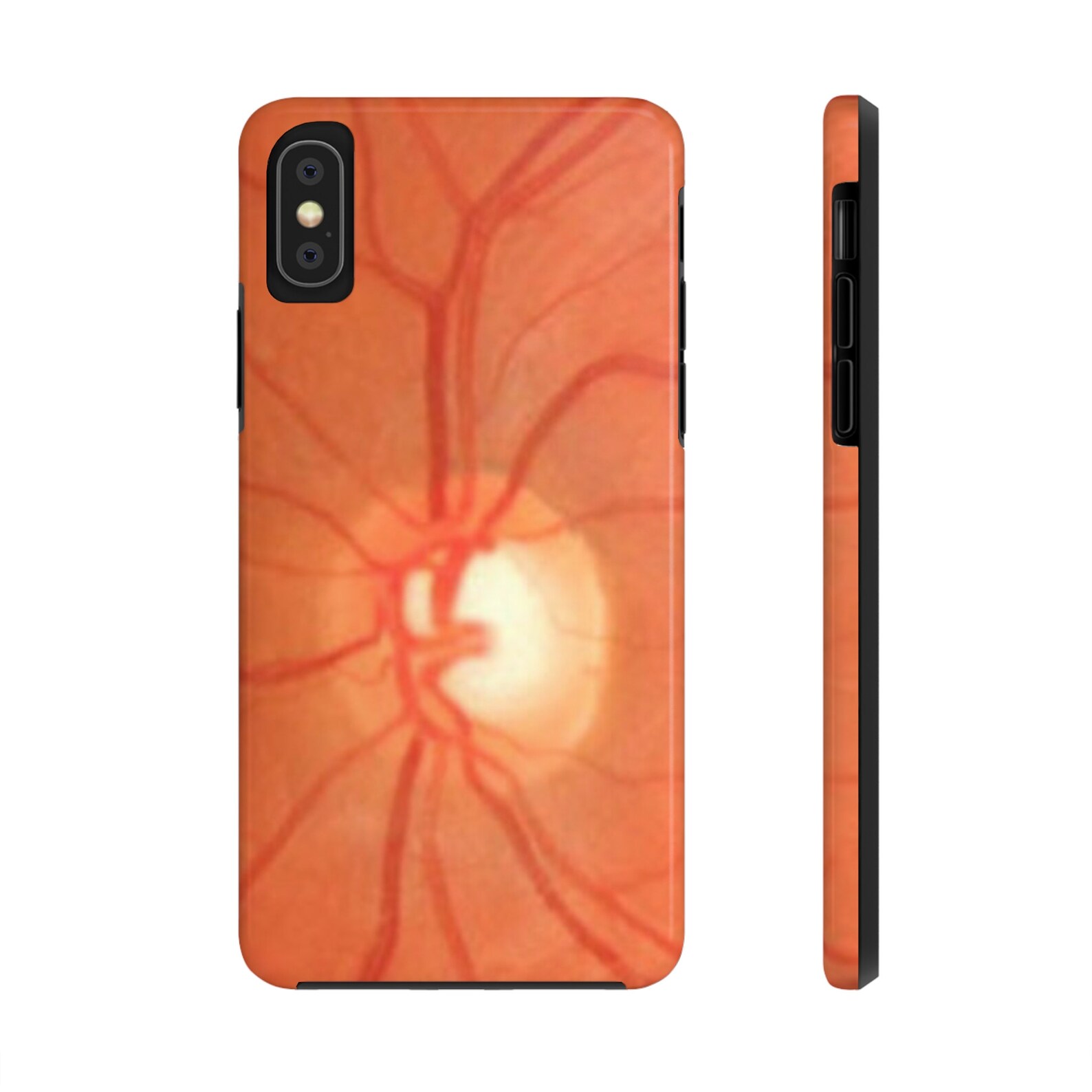 Optometry Phone Case Optometrist iPhone Case Ophthalmologist Retina ...