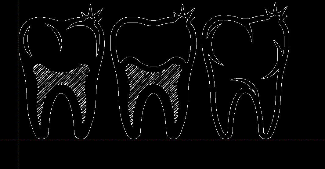 Metal Teeth Wall Art Decor, Dxf Digital Download, Wooden Wall Art ...