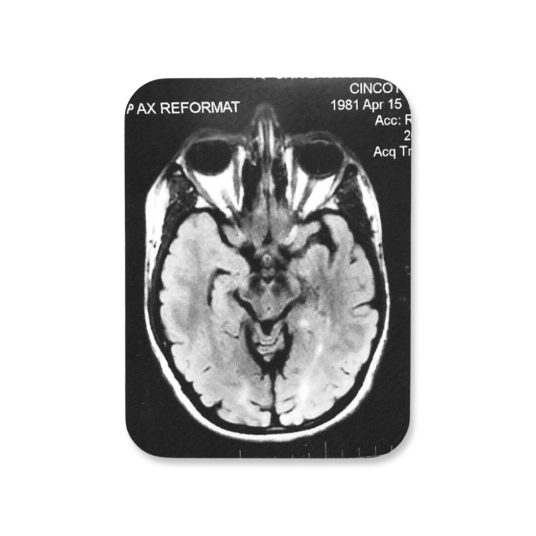 MRI Brain Scan Multiple Sclerosis Handmade STICKER - Etsy
