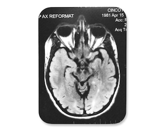 Little Miss MRI Tech Vinyl Sticker Waterproof MRI Gift MRI - Etsy