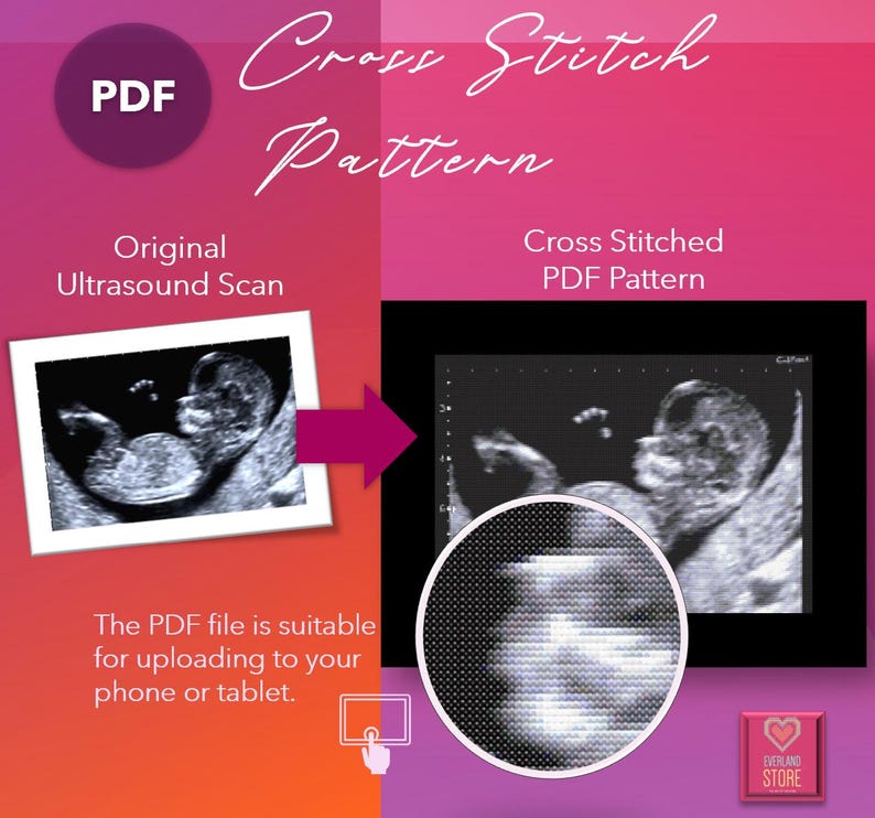 Baby Ultrasound Scan Cross Stitch Pattern Transformed From a Sonogram ...
