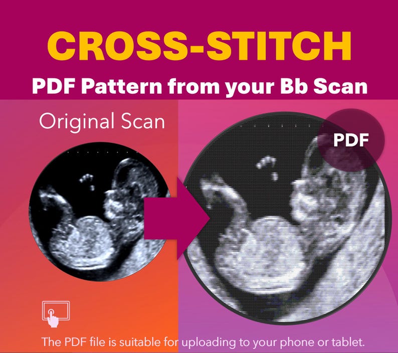 Baby Ultrasound Scan Cross Stitch Pattern Transformed From a Sonogram ...