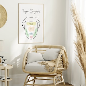 TCM Tongue Diagnosis Chart Poster, Tongue & Organs Map, Tongue ...