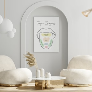 TCM Tongue Diagnosis Chart Poster, Tongue & Organs Map, Tongue ...