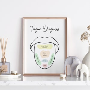 TCM Tongue Diagnosis Chart Poster, Tongue & Organs Map, Tongue ...