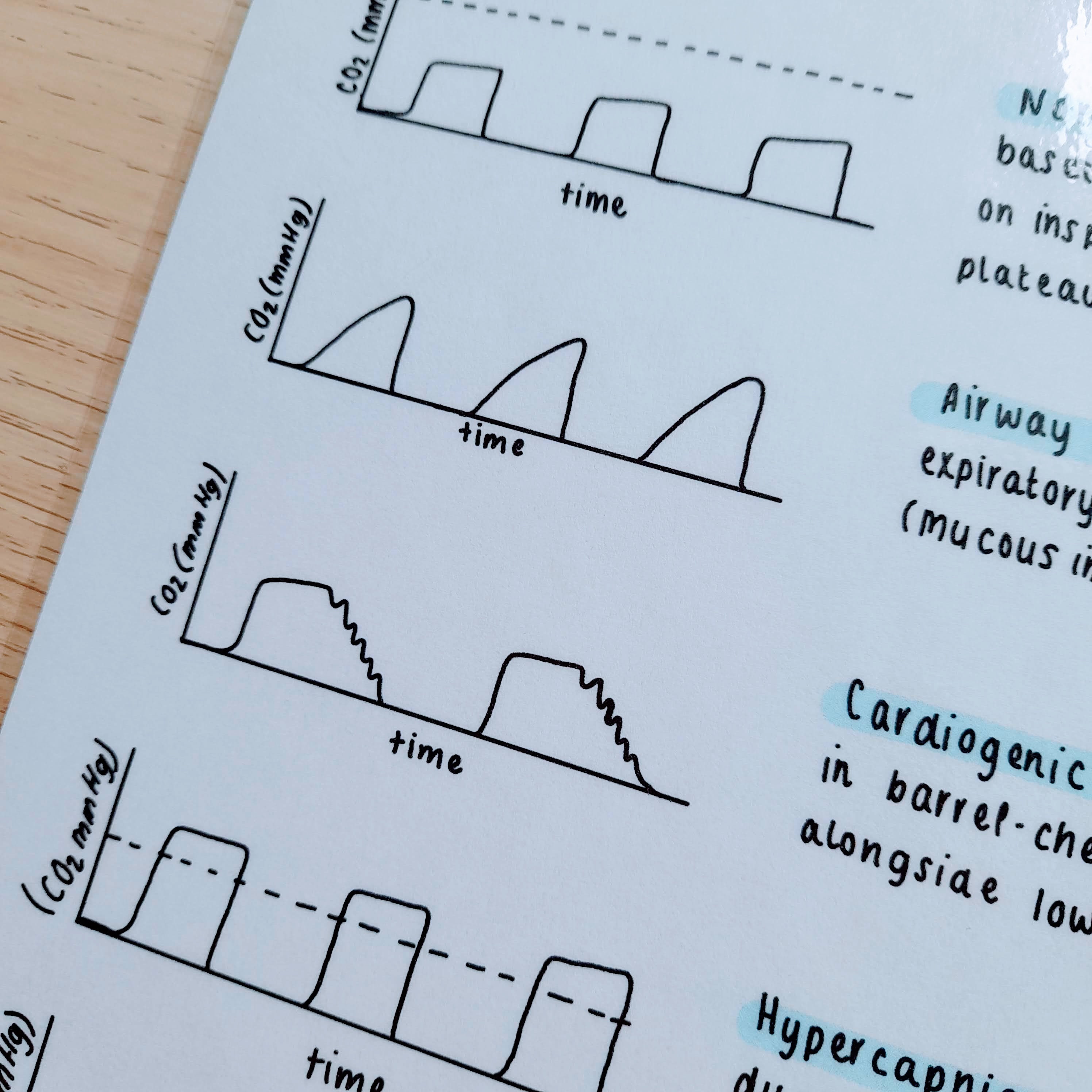 A4 Quick Reference Illustrated Capnography Traces Poster Veterinary ...