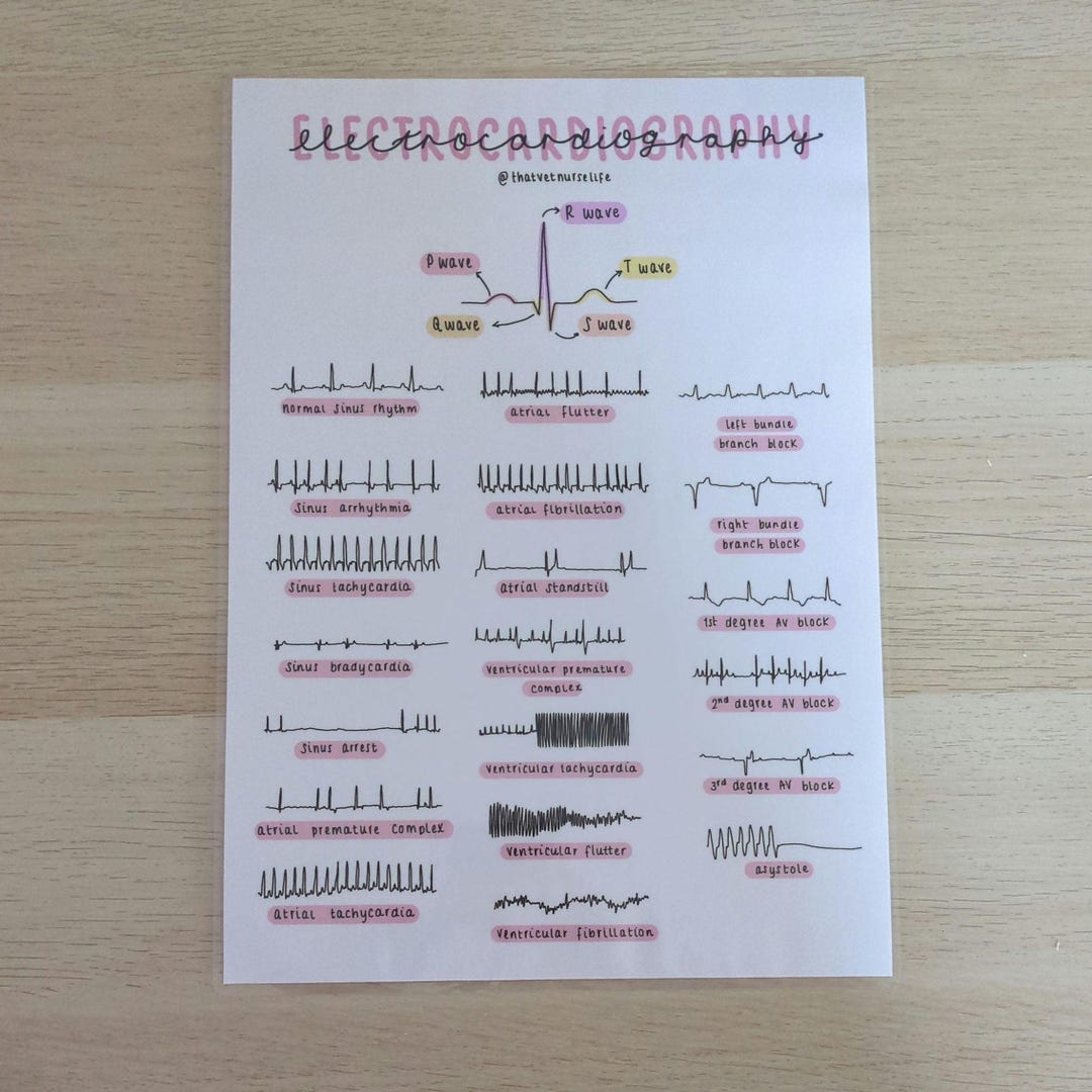 A4 ECG Quick Reference Illustrated Anaesthesia Multiparameter Poster ...